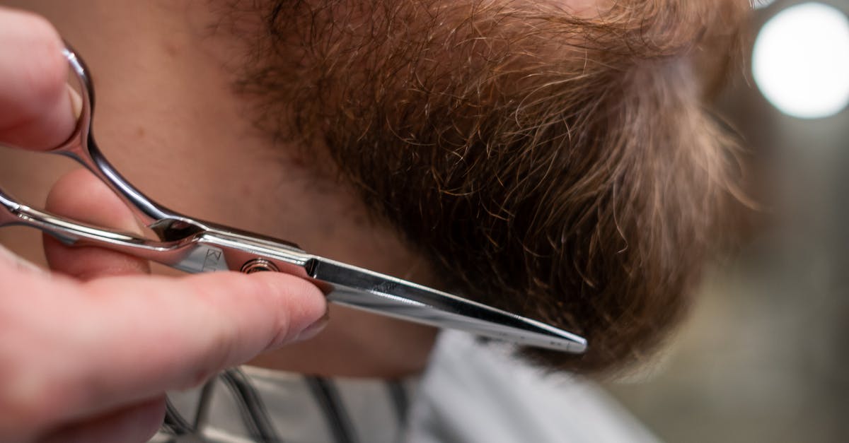 How To Treat Seborrheic Dermatitis? – Merelta